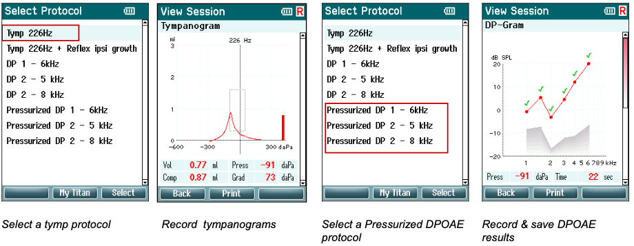 Titan | Pressurized DPOAE | Interacoustics